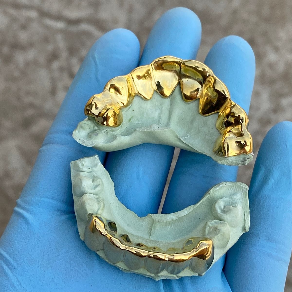 Custom Grillz Gold Plated over 925 Silver Handmade Grillz For Teeth