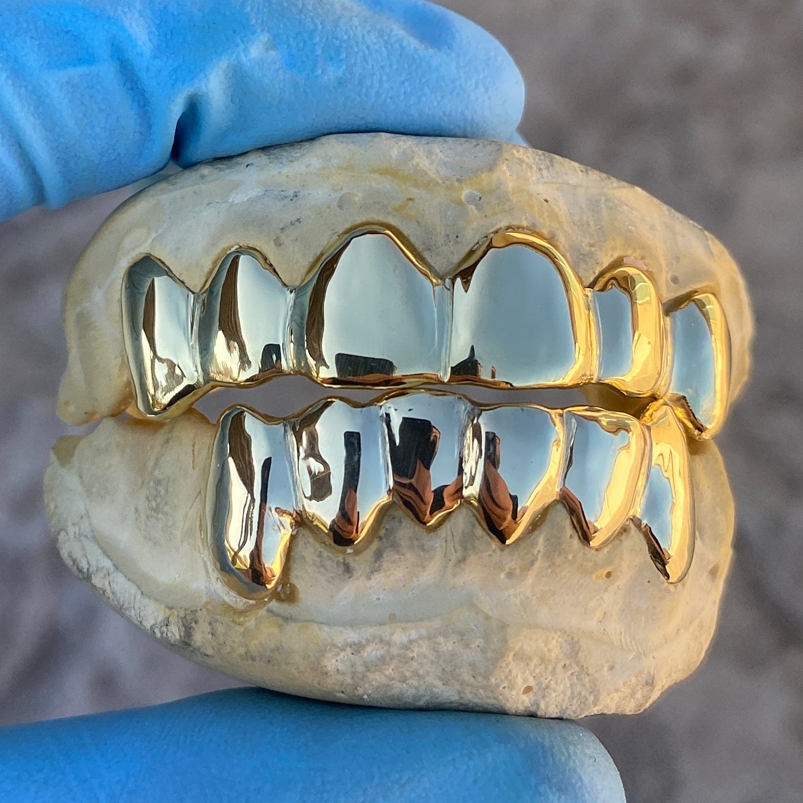 Custom Grillz | 14K Gold Plated Grillz | Teeth Grillz