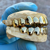 Permanent cuts gold plated custom grillz. Gold plated over real solid ...