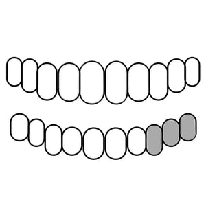 Real Solid 10K Gold Custom Grillz Three Side Teeth Grills