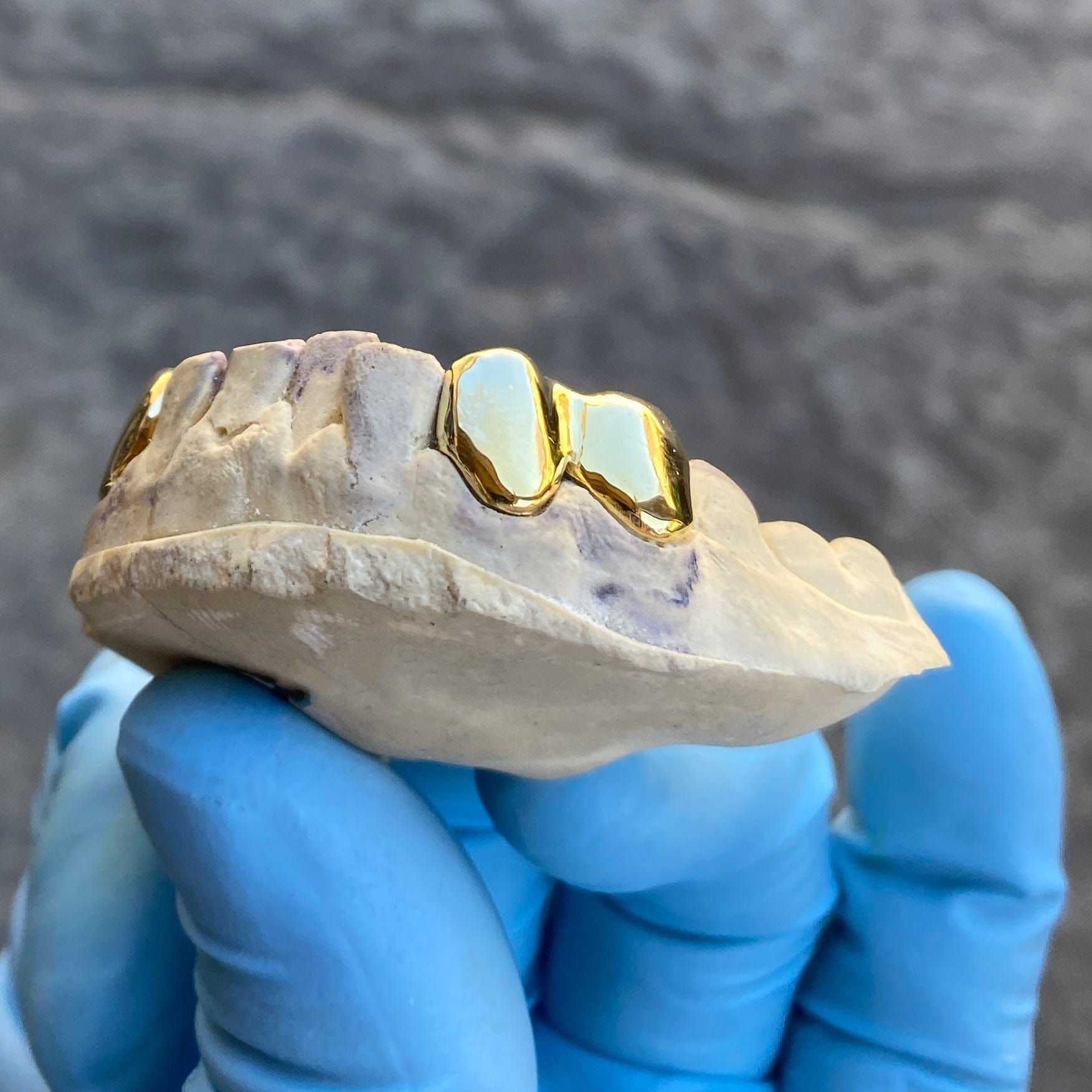 Real 10K Gold Double Caps Side Canine Custom Grillz