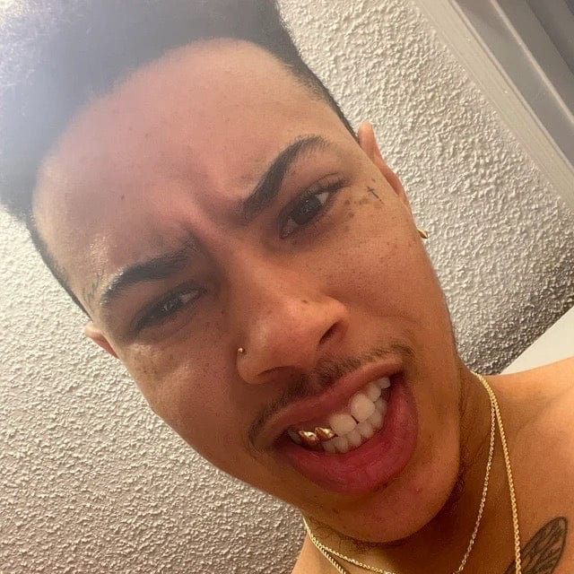 Real 10K Gold Double Caps Side Canine Custom Grillz