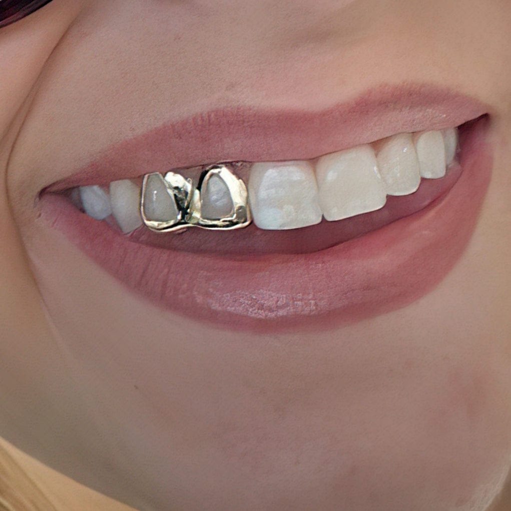 Real 10K Gold Double Side Canine Open Face Caps Custom Grillz