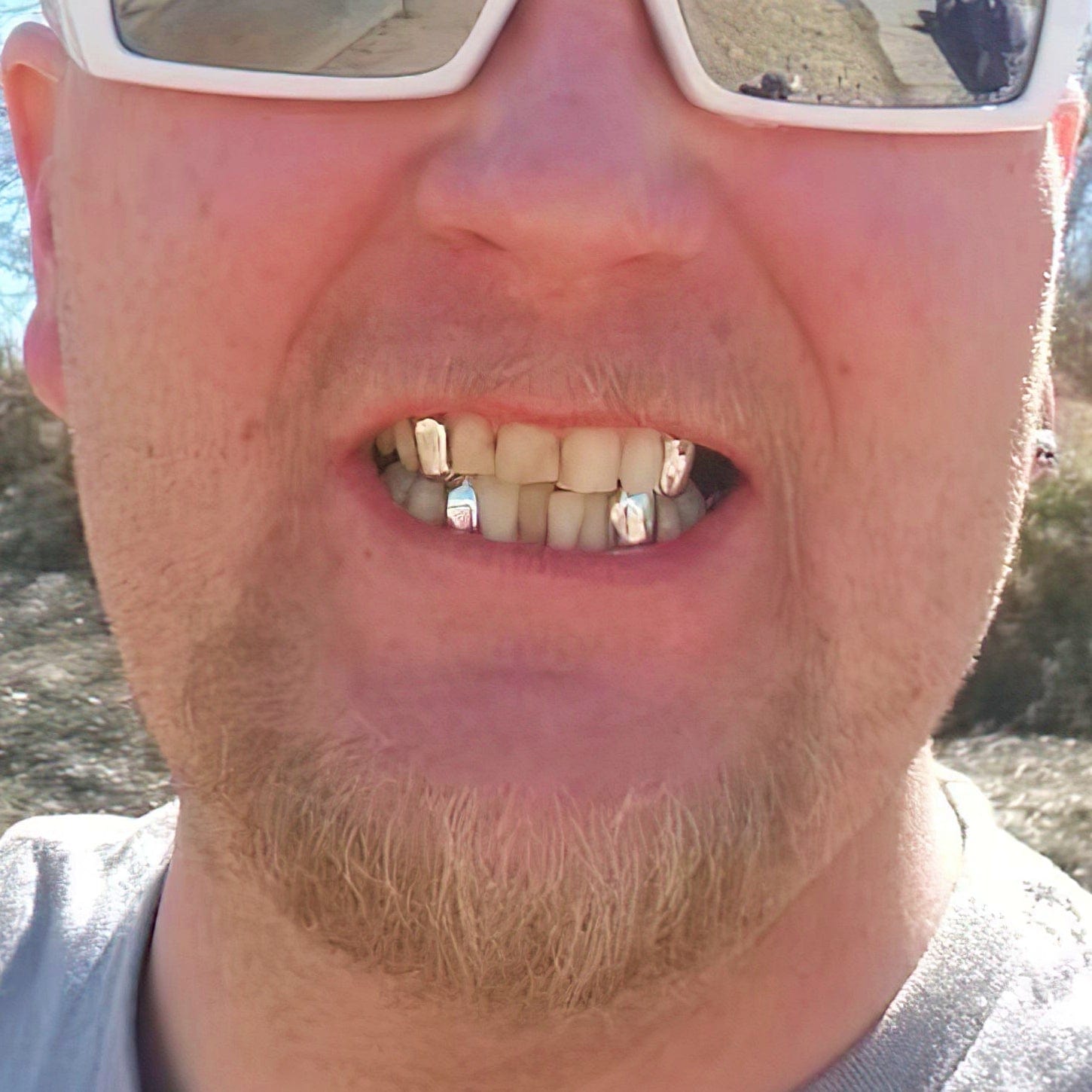 Real Solid 10k Gold Custom Single Teeth Caps