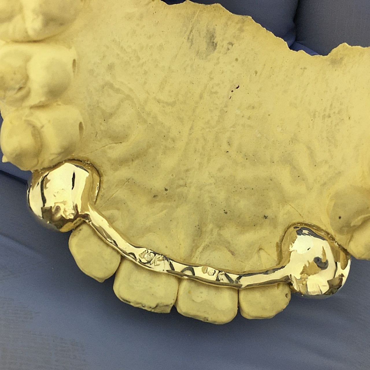 Real 10K Gold Open Face Canine Custom Caps Grillz