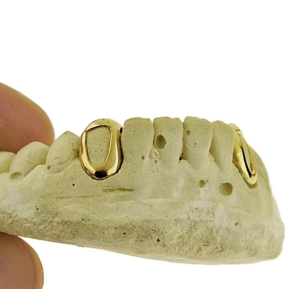 Real 10K Gold Open Face Canine Custom Caps Grillz