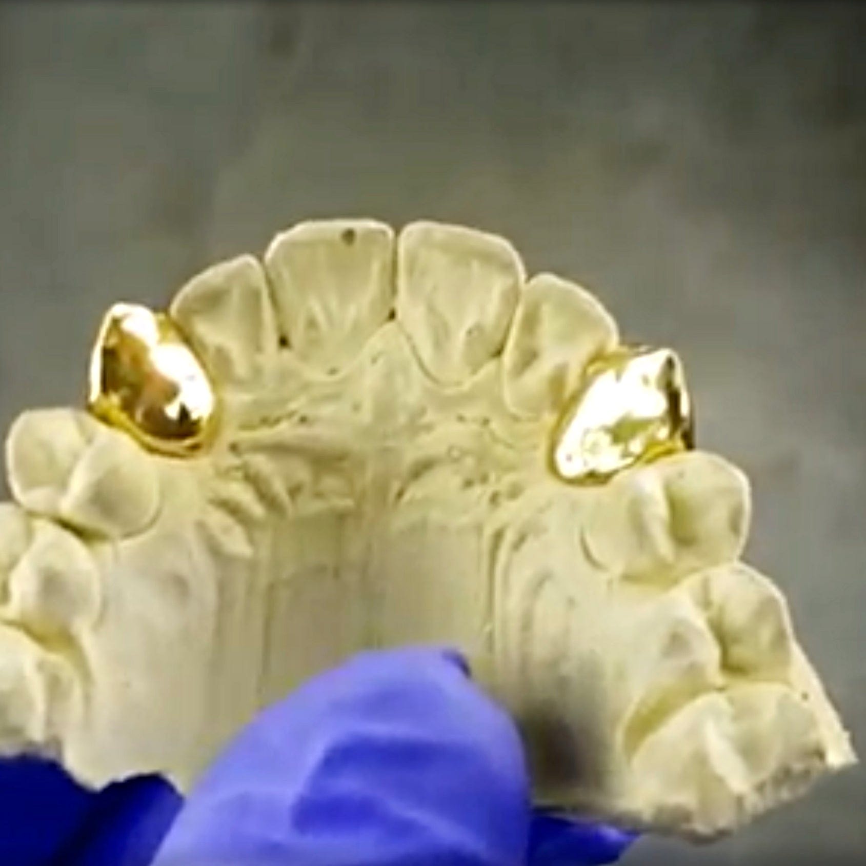 Real 10k Gold Vampire Teeth Vampire Canine Fangs Custom Grillz