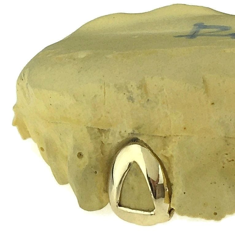 Real 10K Solid Gold Open Face Single Cap Grillz (Choose Tooth)