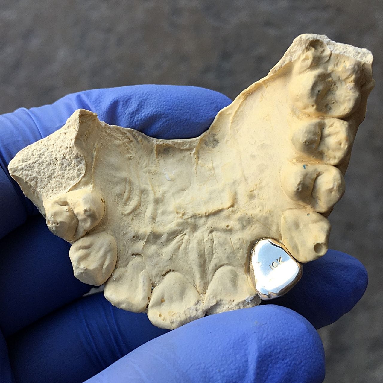 Real 10K Solid Gold Open Face Single Cap Grillz (Choose Tooth)