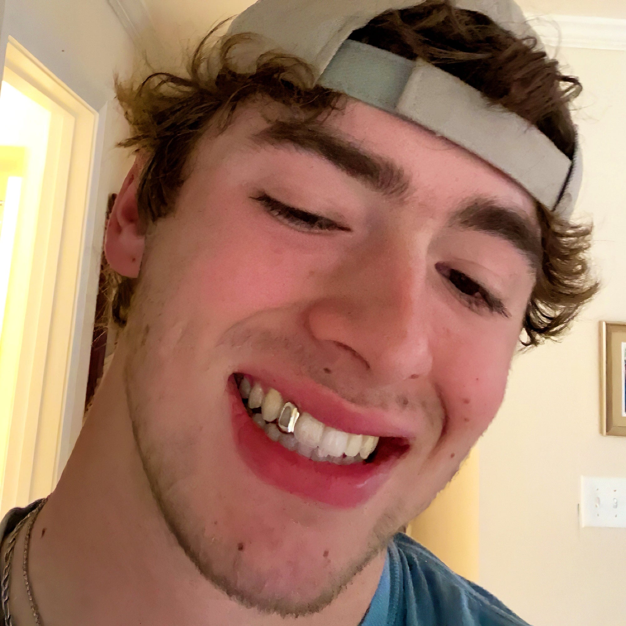 Real 10K Solid Gold Open Face Single Cap Grillz (Choose Tooth)