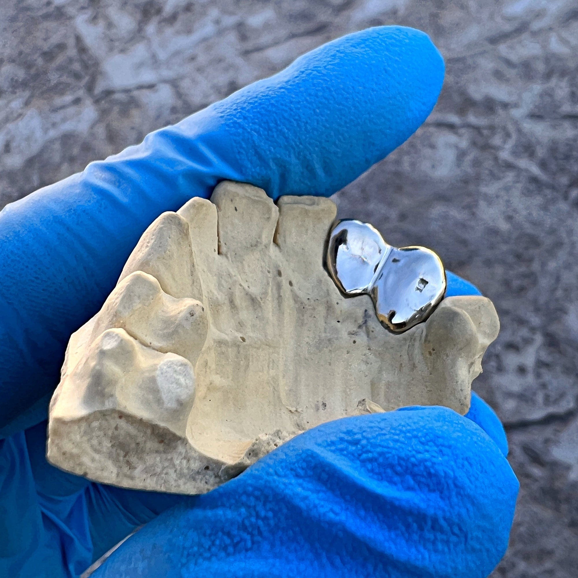 Real 10K White Gold Double Caps Side Canine Custom Grillz