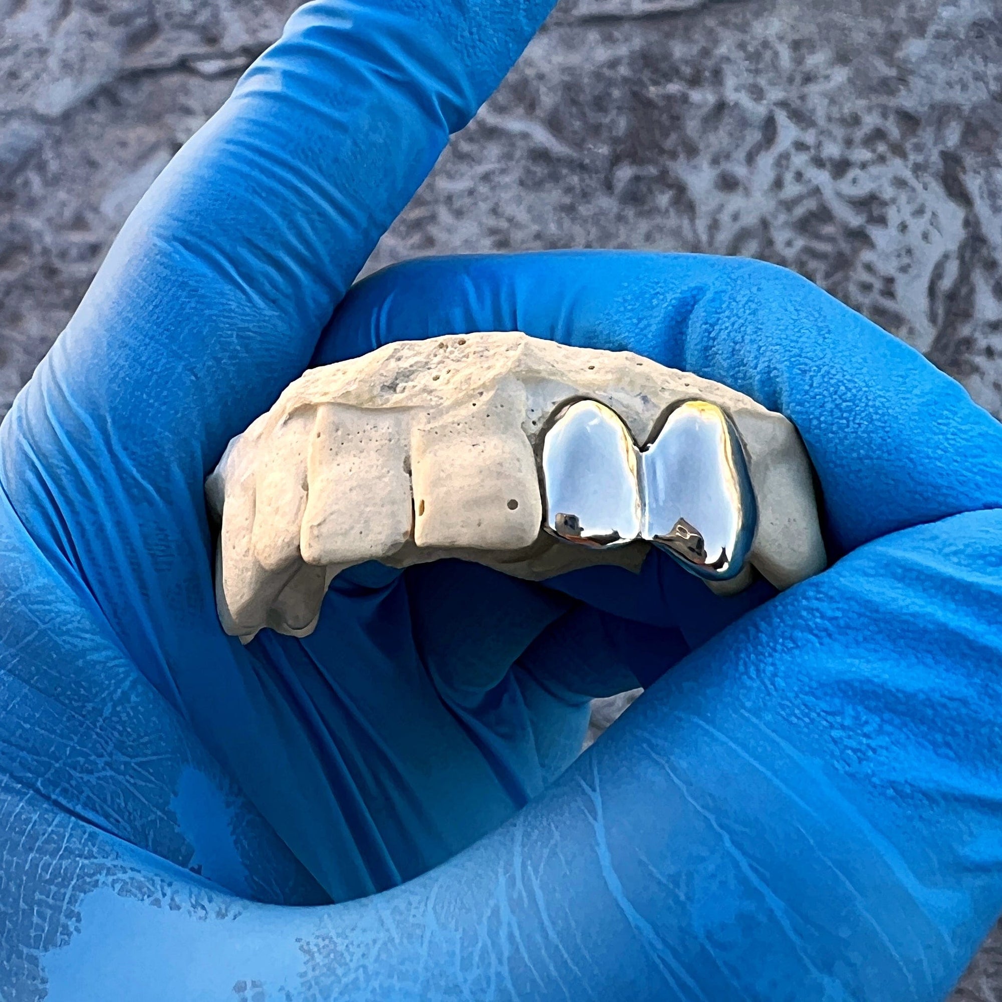 Real 10K White Gold Double Caps Side Canine Custom Grillz