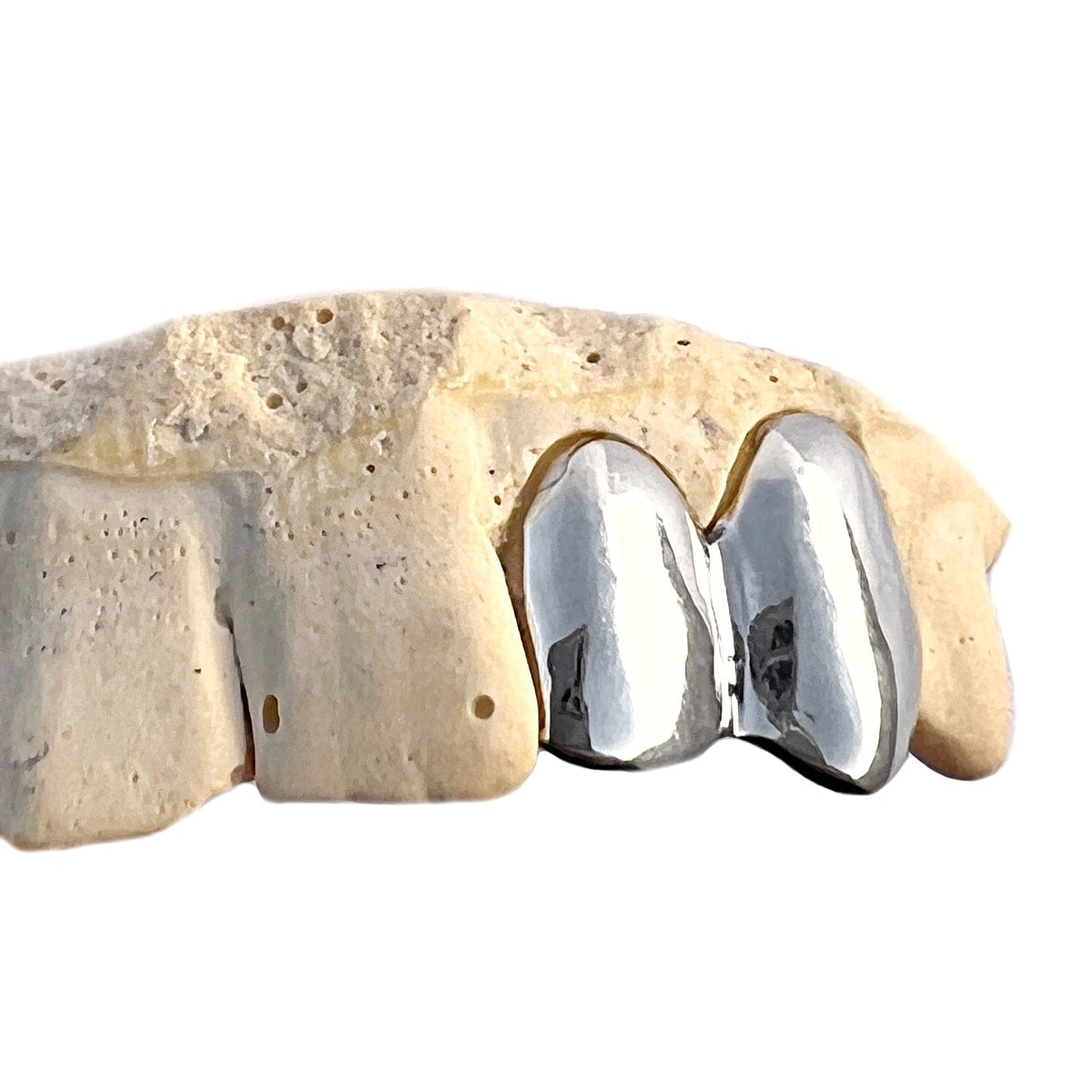 Real 10K White Gold Double Caps Side Canine Custom Grillz