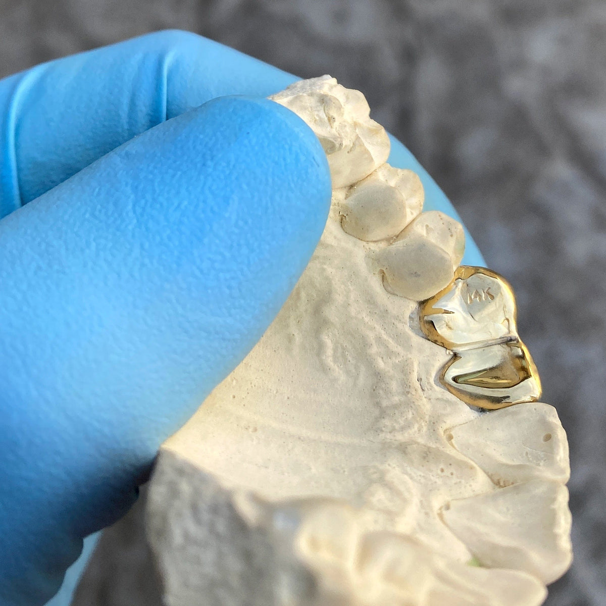 Real 14K Gold Double Side Canine Open Face Caps Custom Grillz