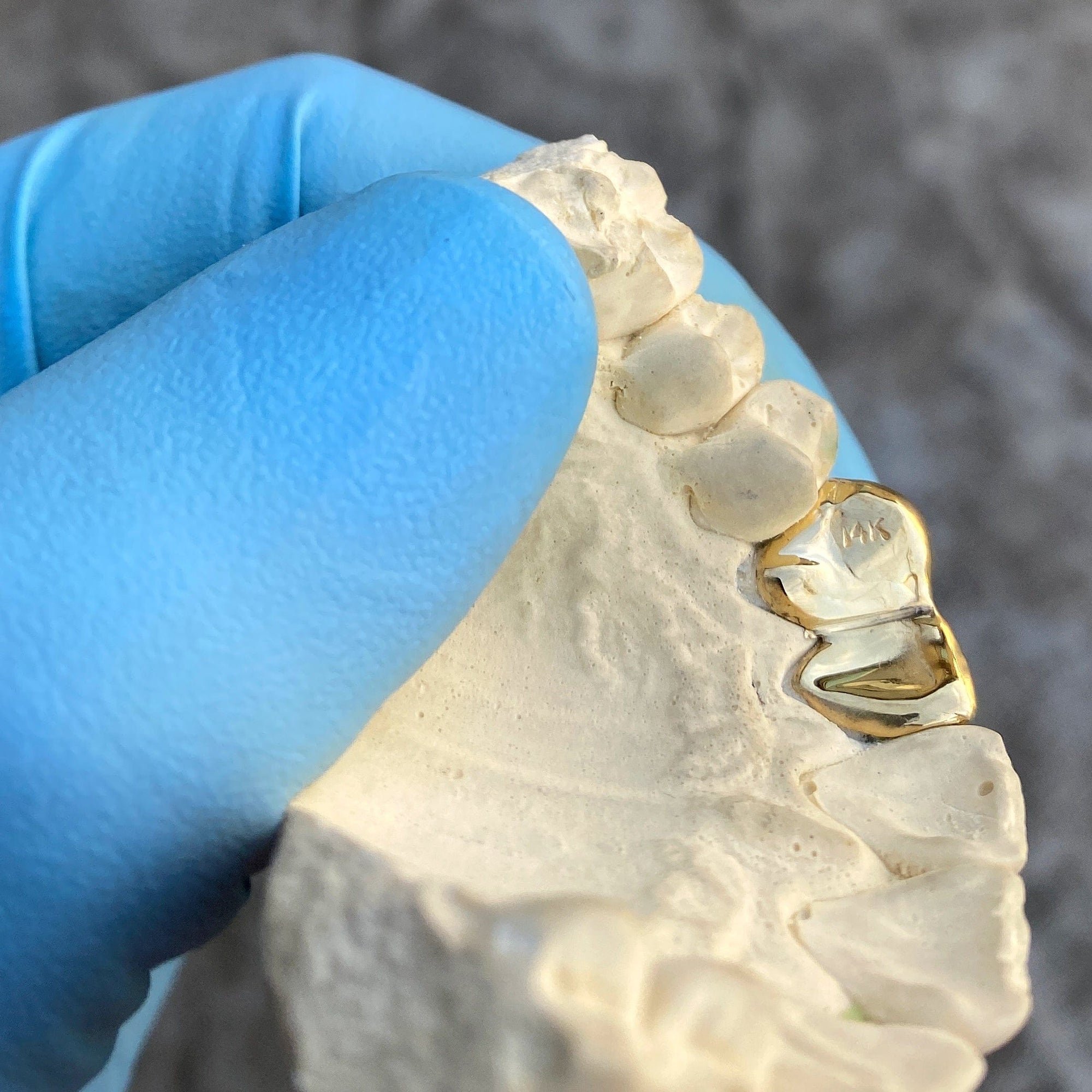 Real 14K Gold Double Side Canine Open Face Caps Custom Grillz