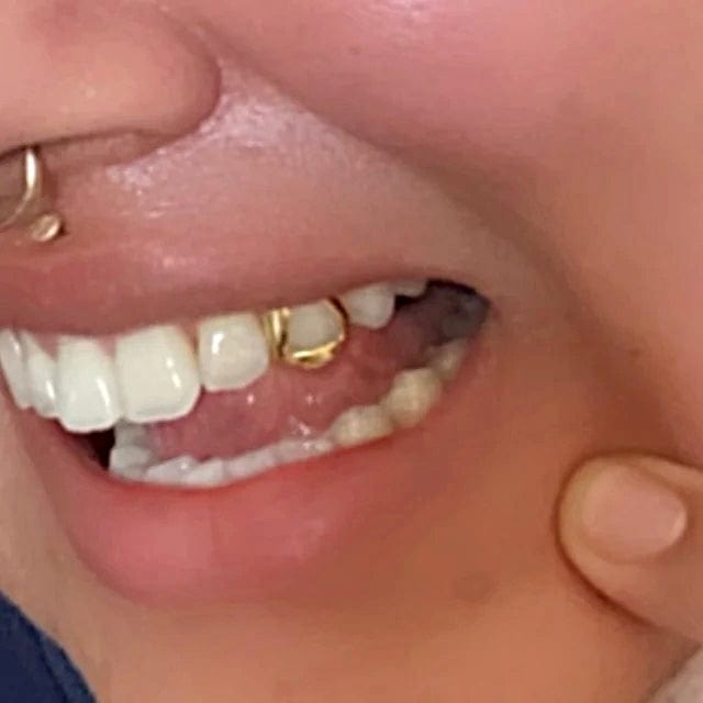 Real 14K Gold Open Face Canine Custom Tooth Cap Custom Grillz