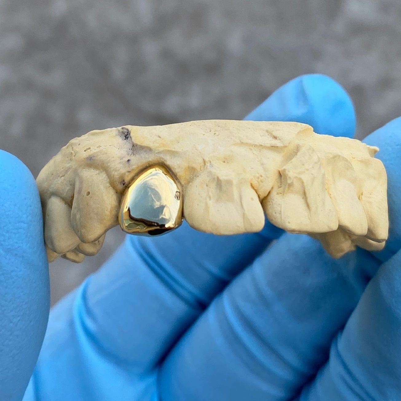 Real 18K Solid Gold Single Cap Custom Grillz (Choose Any Tooth)