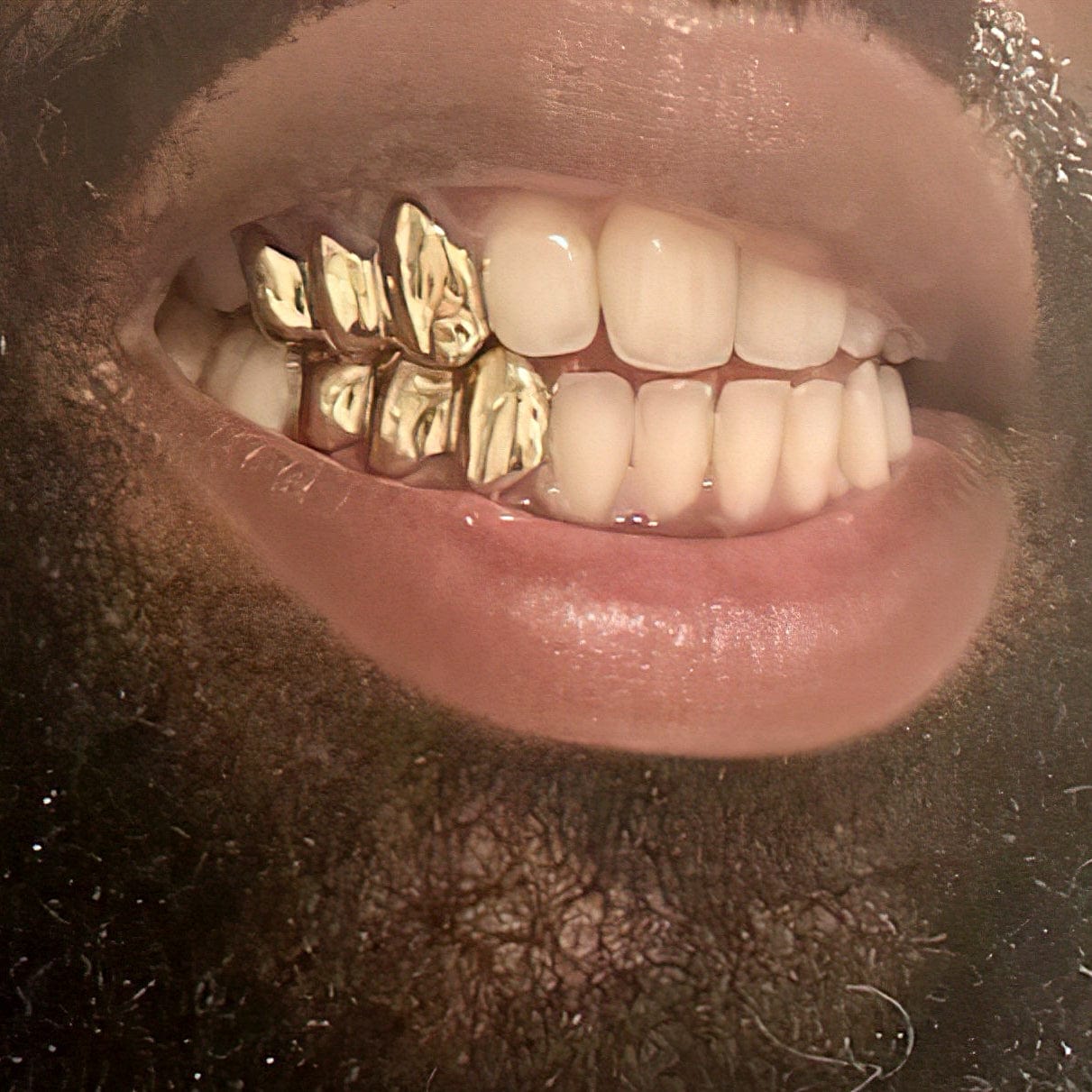 Real Solid 10K Gold Custom Grillz Three Side Teeth Grills