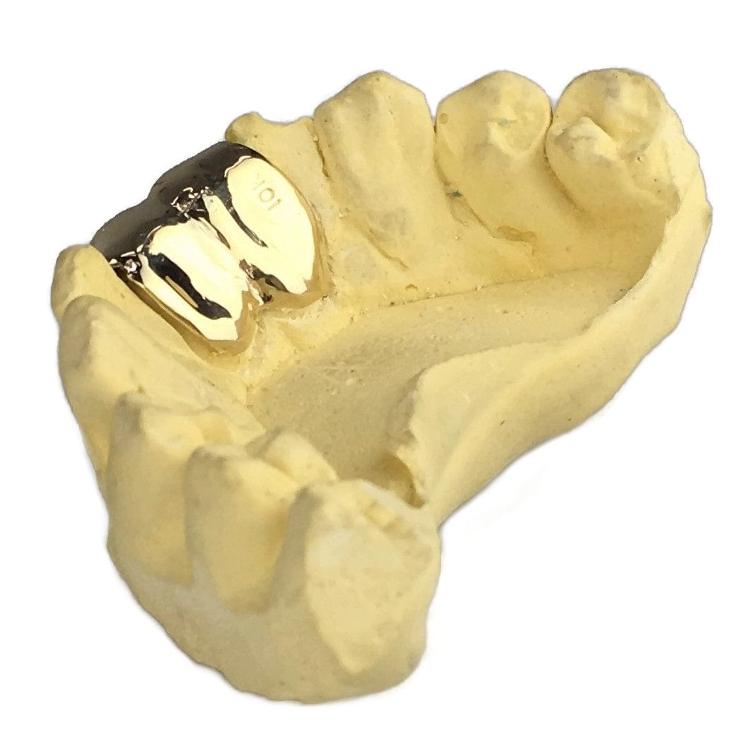Real Solid 10K Gold Double Front Teeth Custom Grillz