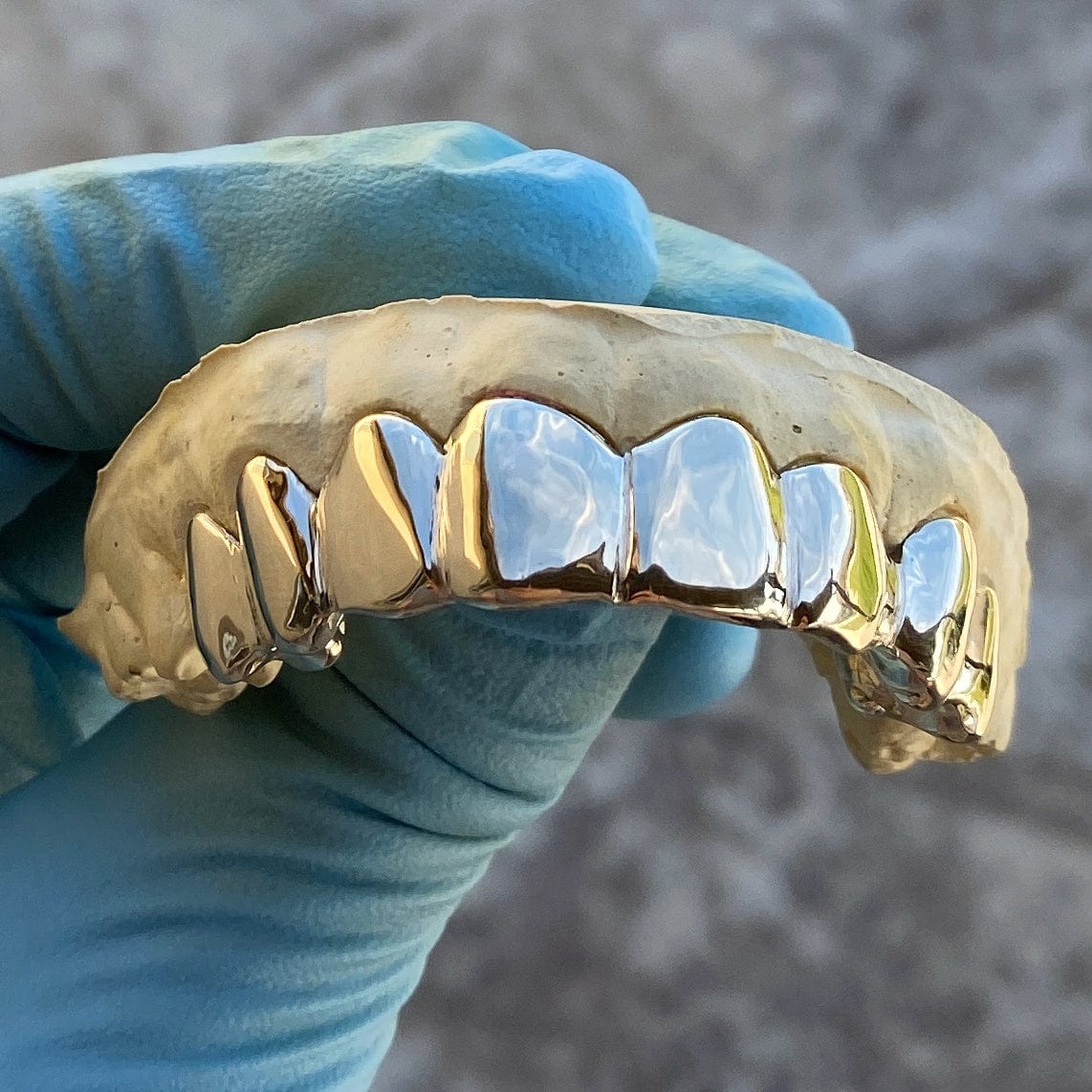 Custom Grillz: Real Solid 10K Gold Teeth