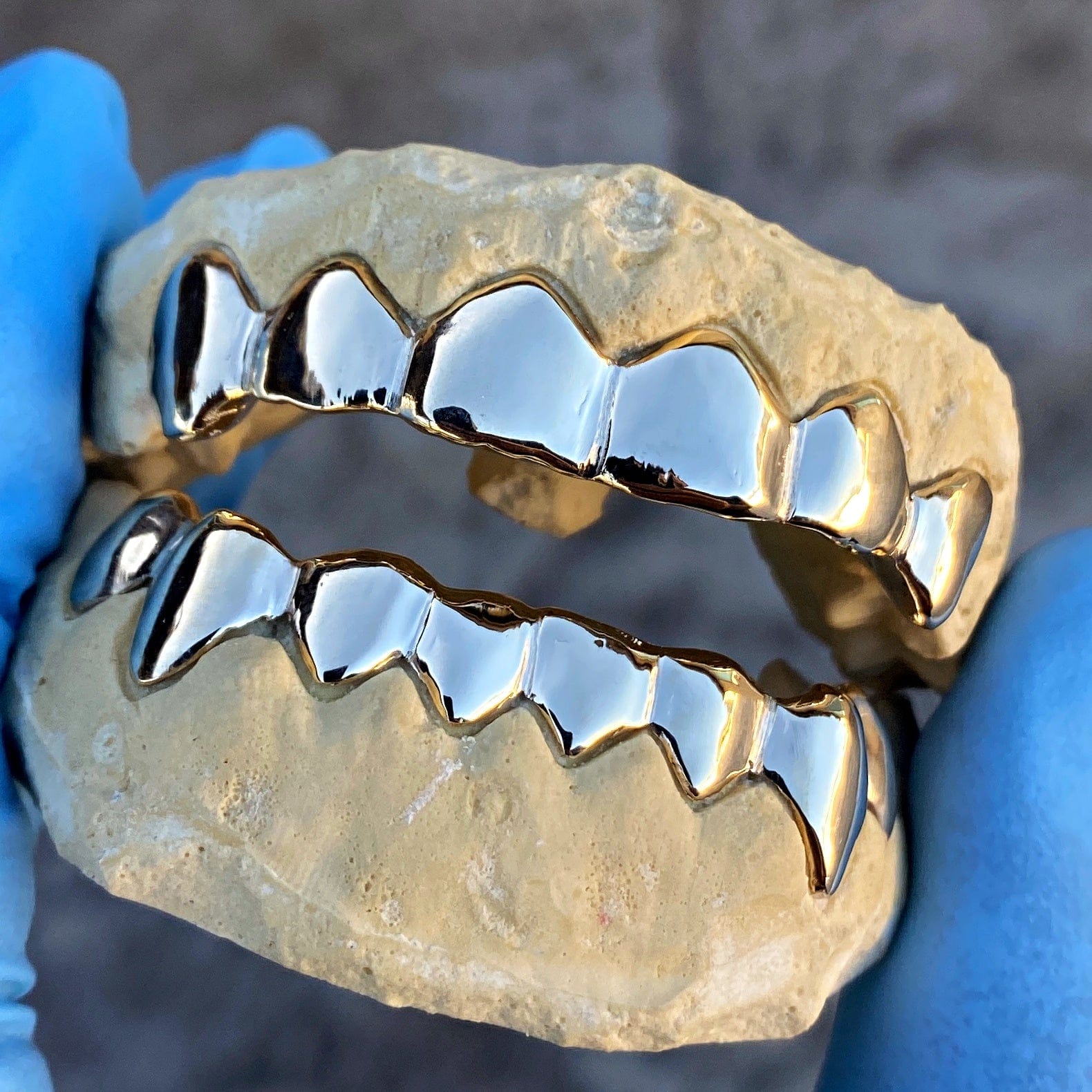 Custom Grillz: Real Solid 10K Gold Teeth