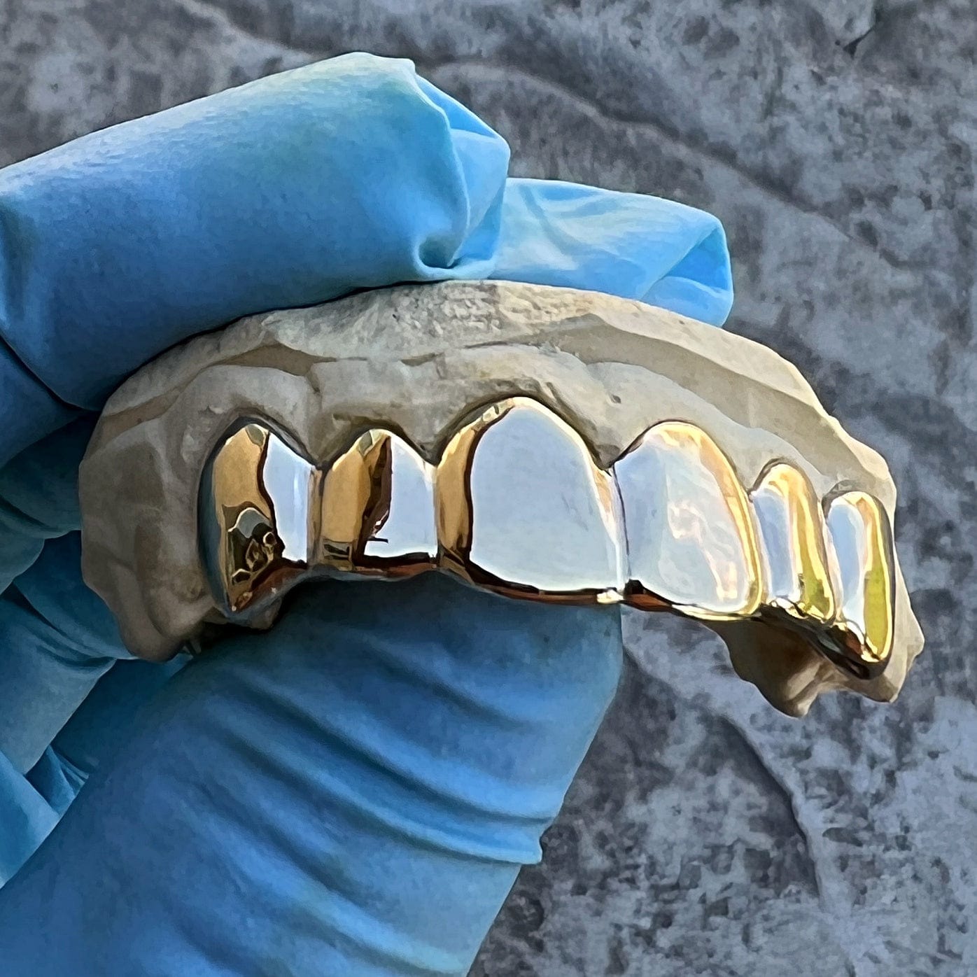 Custom Grillz: Real Solid 10K Gold Teeth