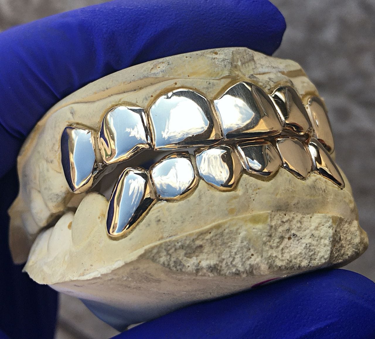 Real Solid 14K Gold Permanent Look Single Caps Custom Grillz