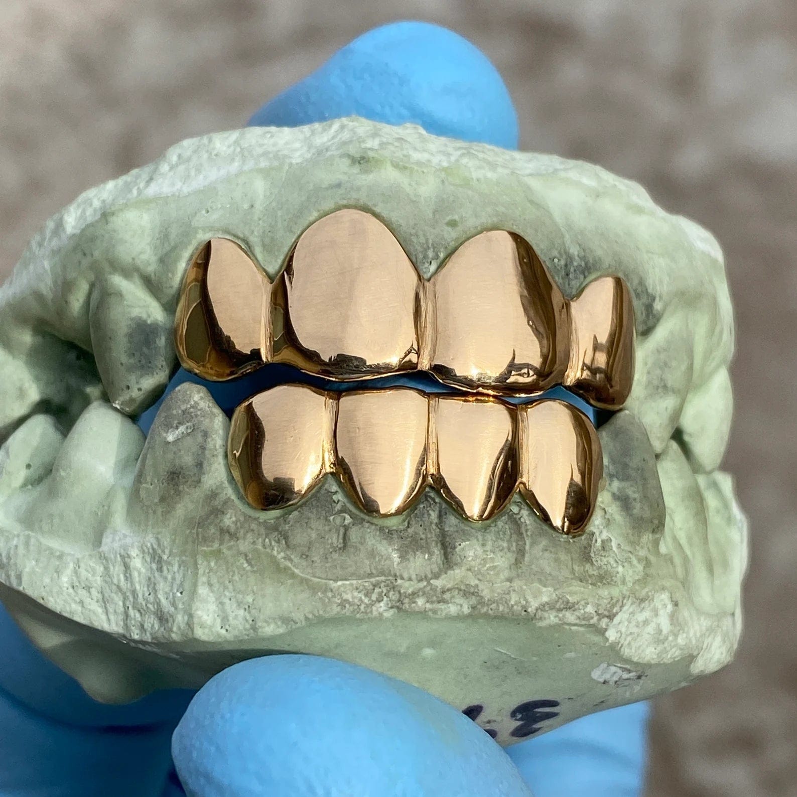 22K Gold Custom Grillz Teeth or Single One Tooth Cap