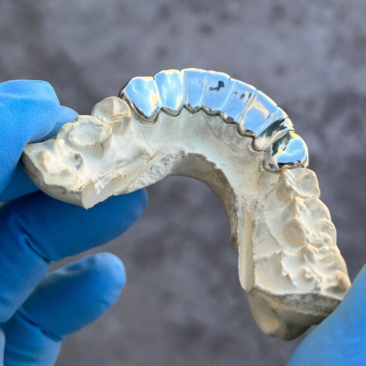 Custom Grillz | Solid 925 Sterling SIlver Teeth Grills