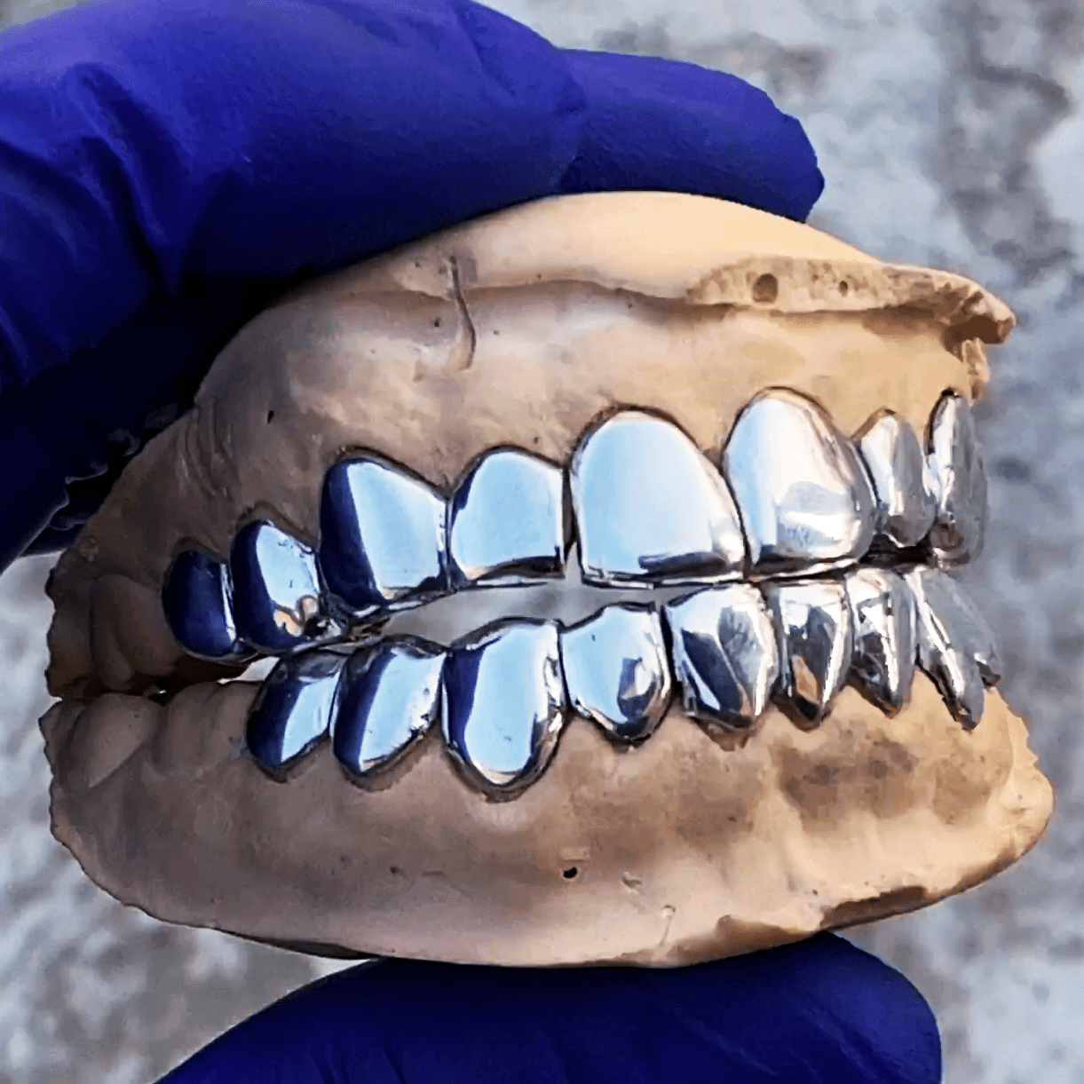 Real Solid 925 Sterling Silver Permanent Look Single Caps Custom Grill