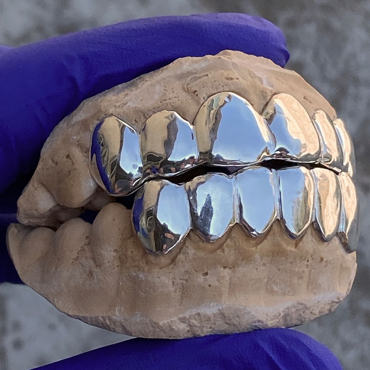 Custom 925 Silver Grillz – High-Quality, Stylish & Tailored Fit | Bling ...