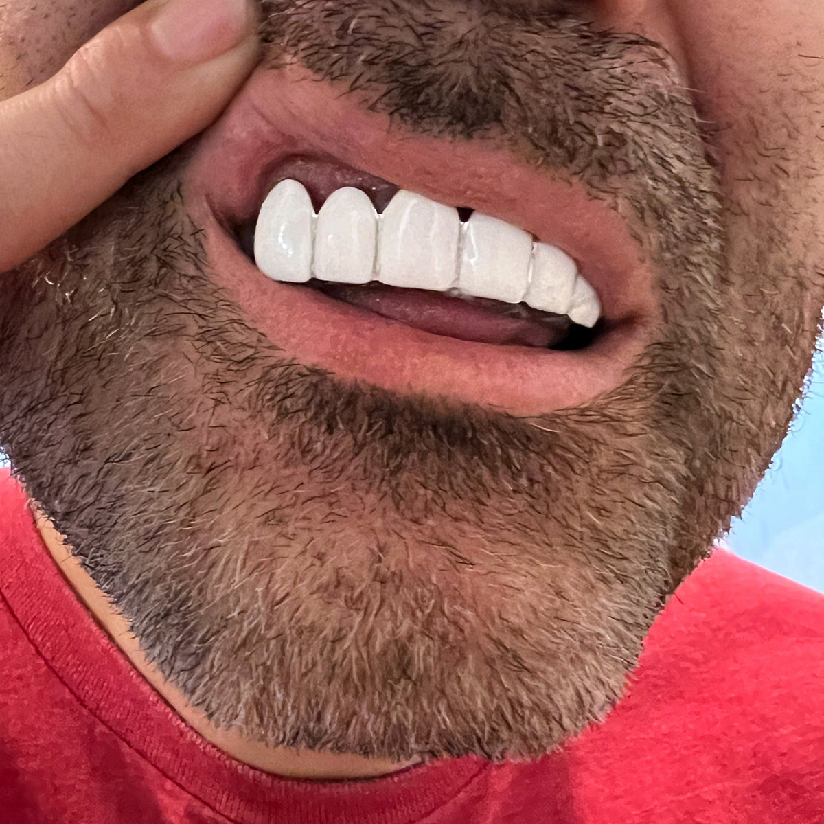 Real Solid 925 Sterling Silver White Enamel Top Six Teeth Grillz