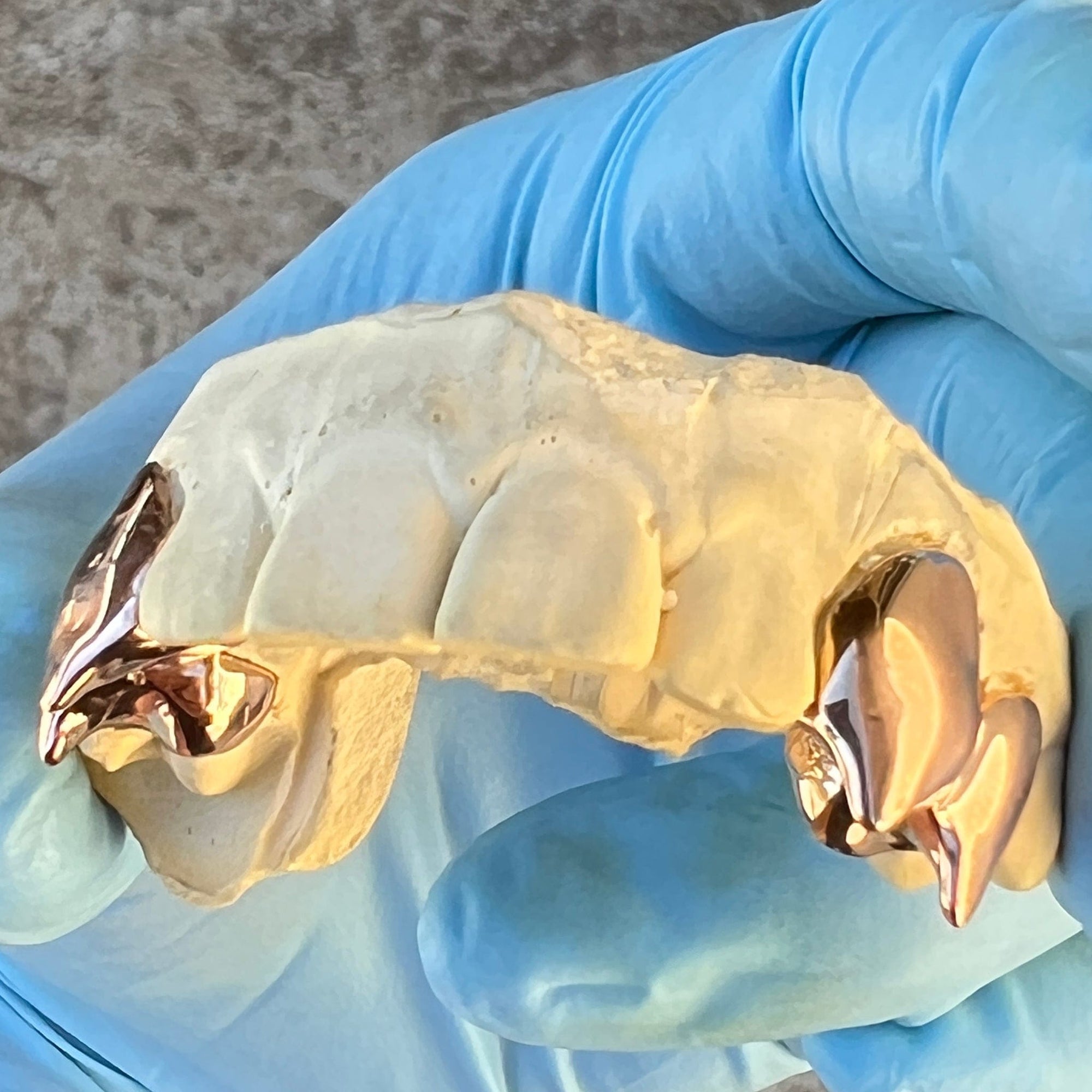 Rose Gold Plated over 925 Silver Custom Double Teeth Vampire Fangs Gri