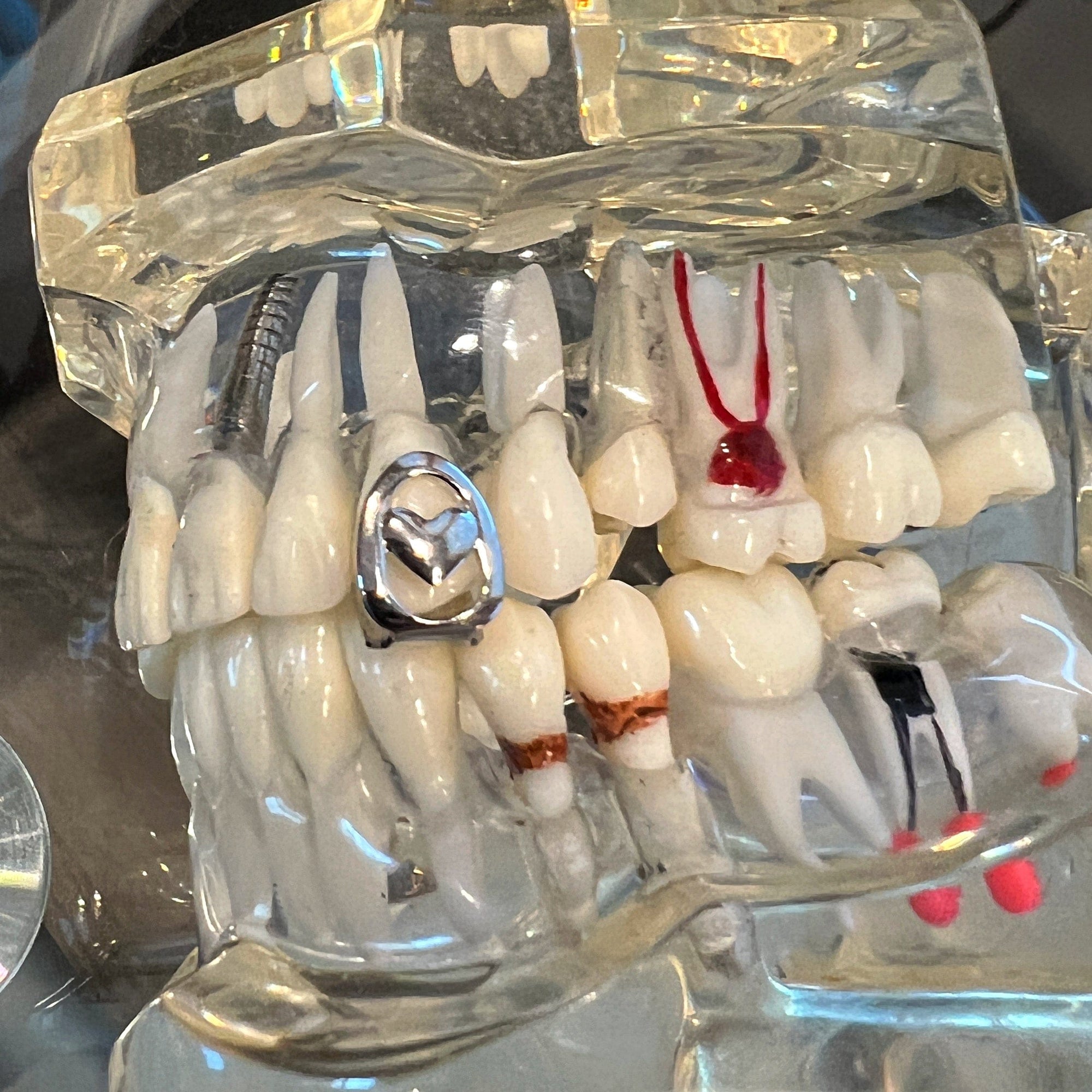 Silver Tone Open Heart Top Tooth Single Cap