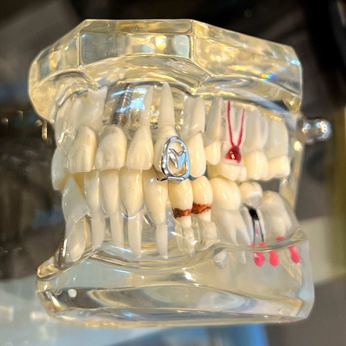 Silver Tone Open Heart Top Tooth Single Cap