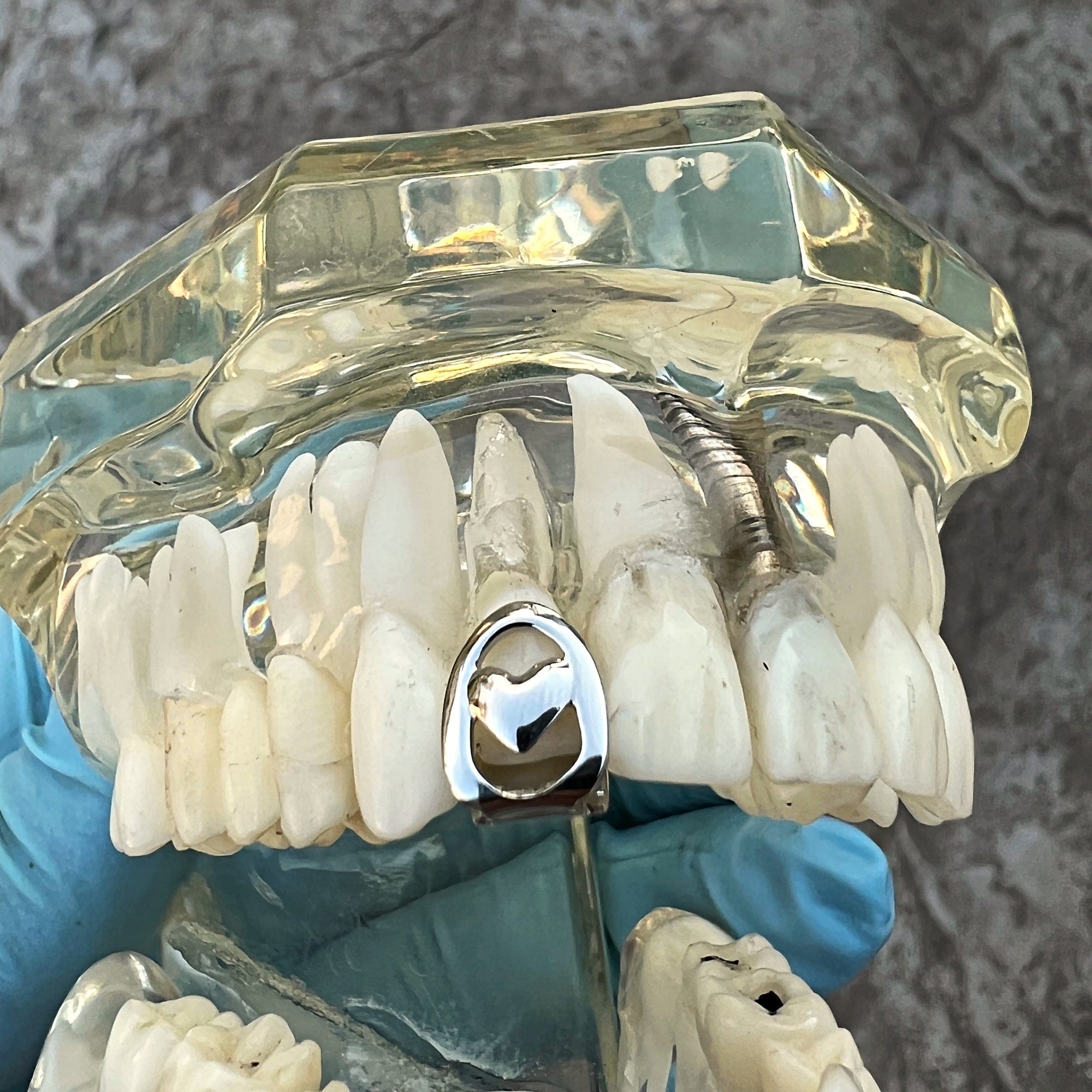 Silver Tone Open Heart Top Tooth Single Cap