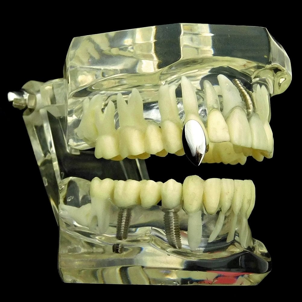 Silver Tone Vampire Fang Top Canine Tooth Cap