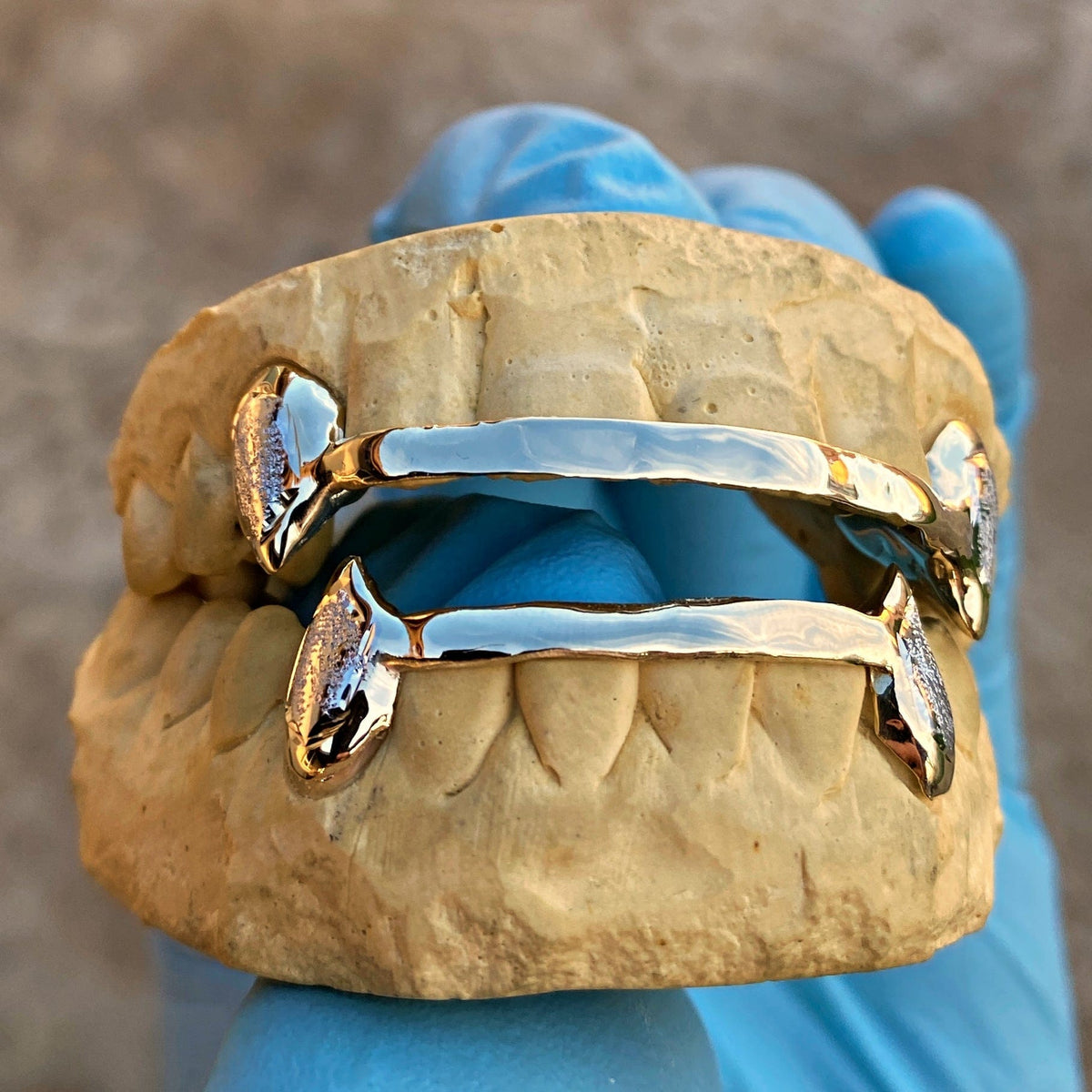 10k Gold Diamond Dust Fang Custom Grillz – Bling Cartel