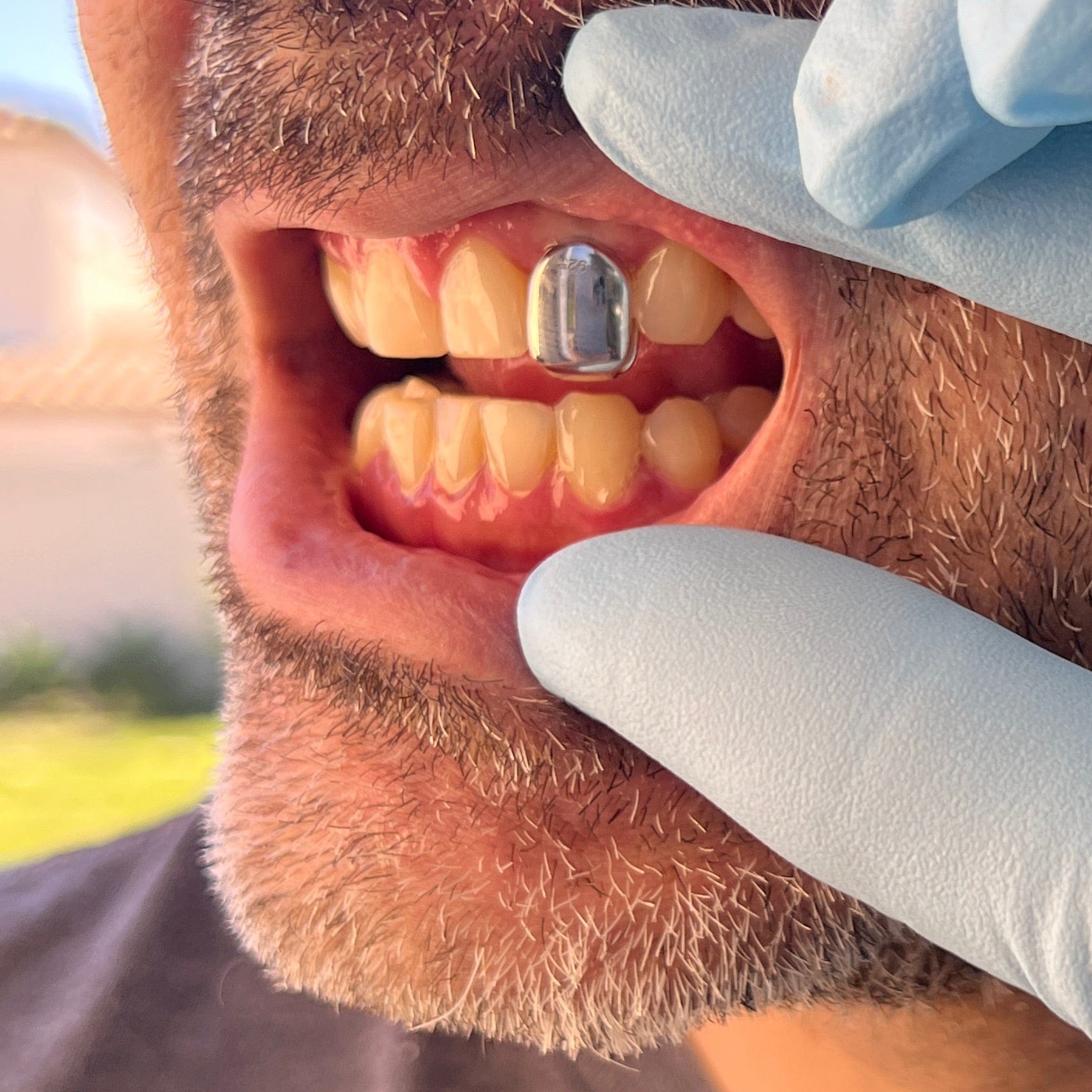 Solid 925 Sterling Silver Single Tooth Cap Grillz