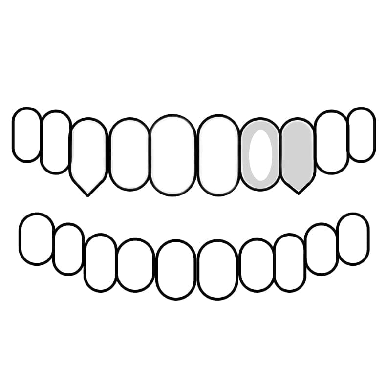 925 Silver Custom Fangs Set Double Caps Vampire Teeth Fang & Open Toot