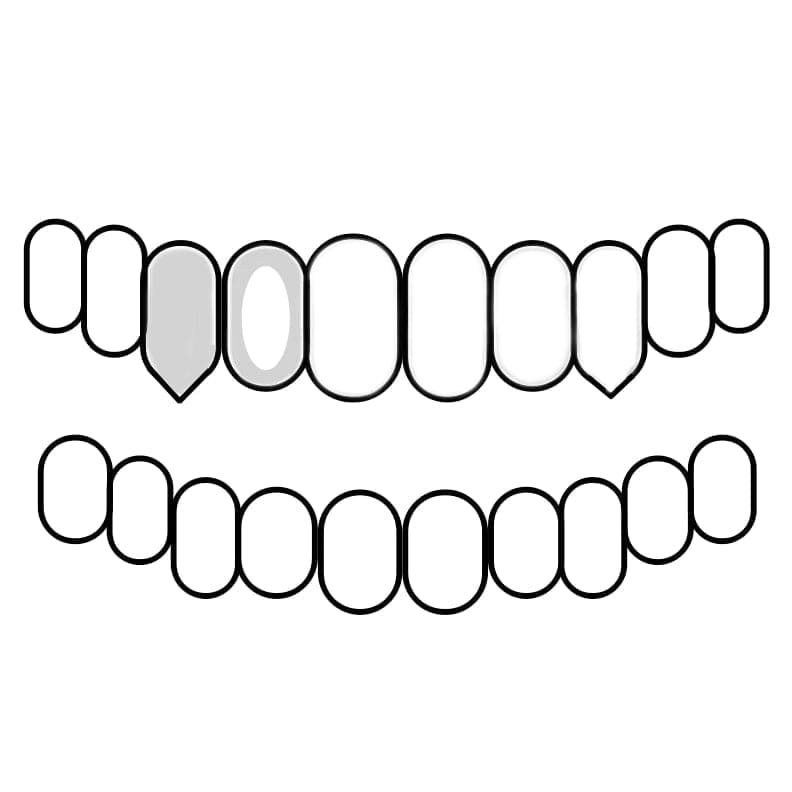 925 Silver Custom Fangs Set Double Caps Vampire Teeth Fang & Open Toot