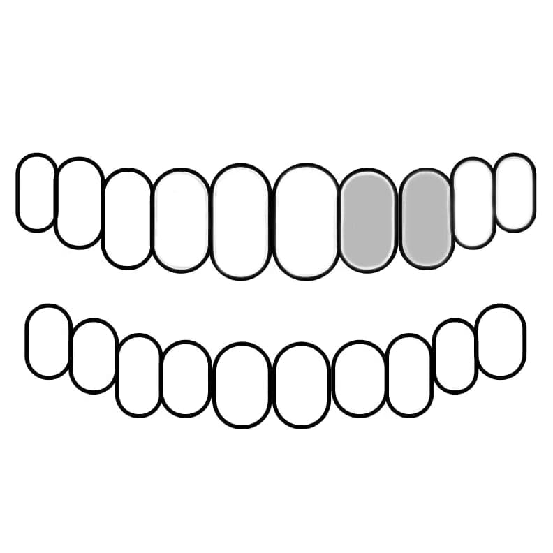 925 Sterling Silver Double Side Canine Teeth Caps Custom Grillz