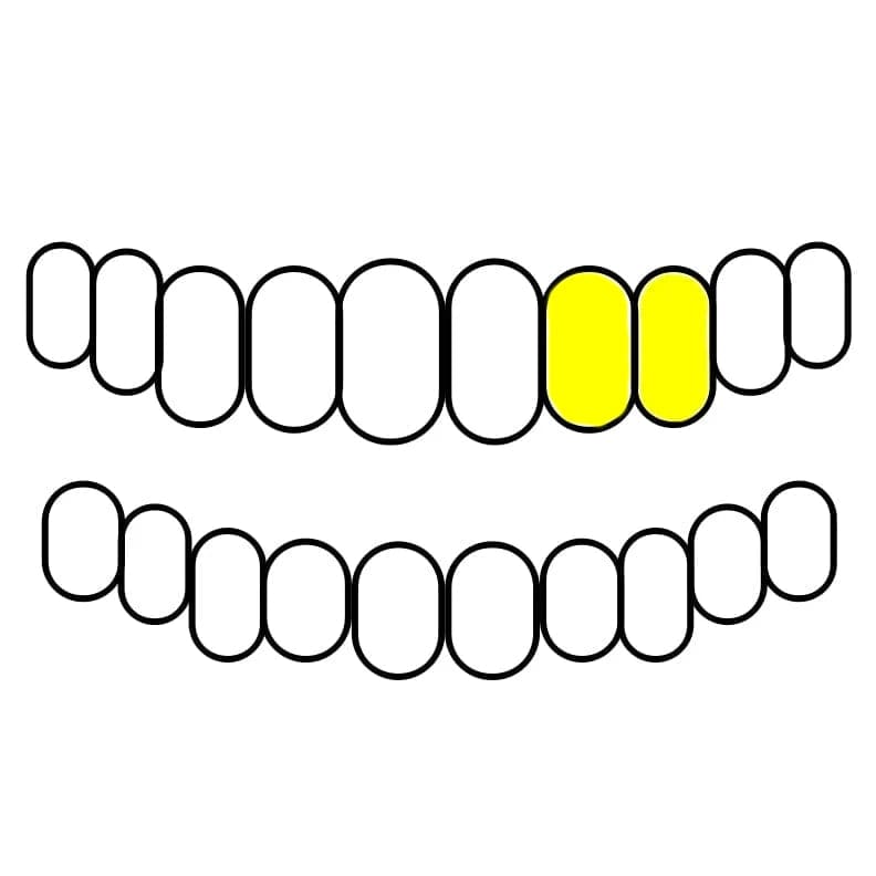 Real 14K Gold Double Side Canine Teeth Custom Grillz