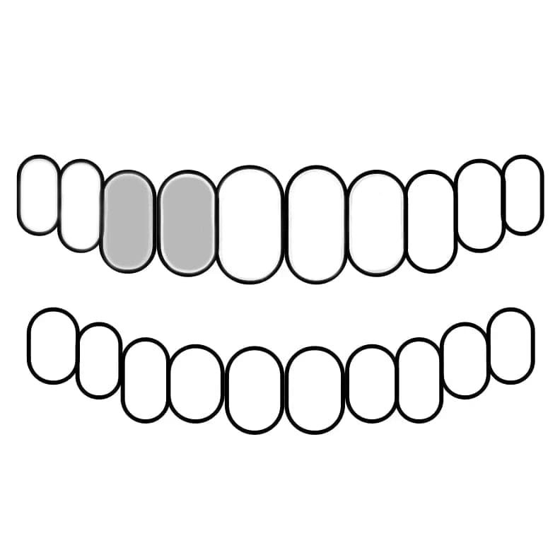 925 Sterling Silver Double Side Canine Teeth Caps Custom Grillz