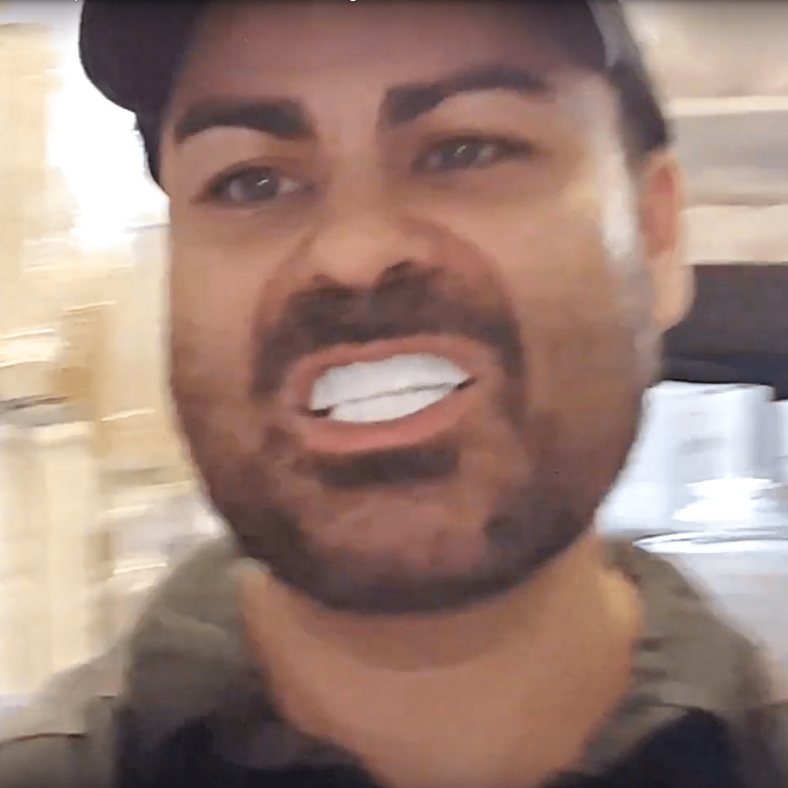 White Top Row Teeth Grillz