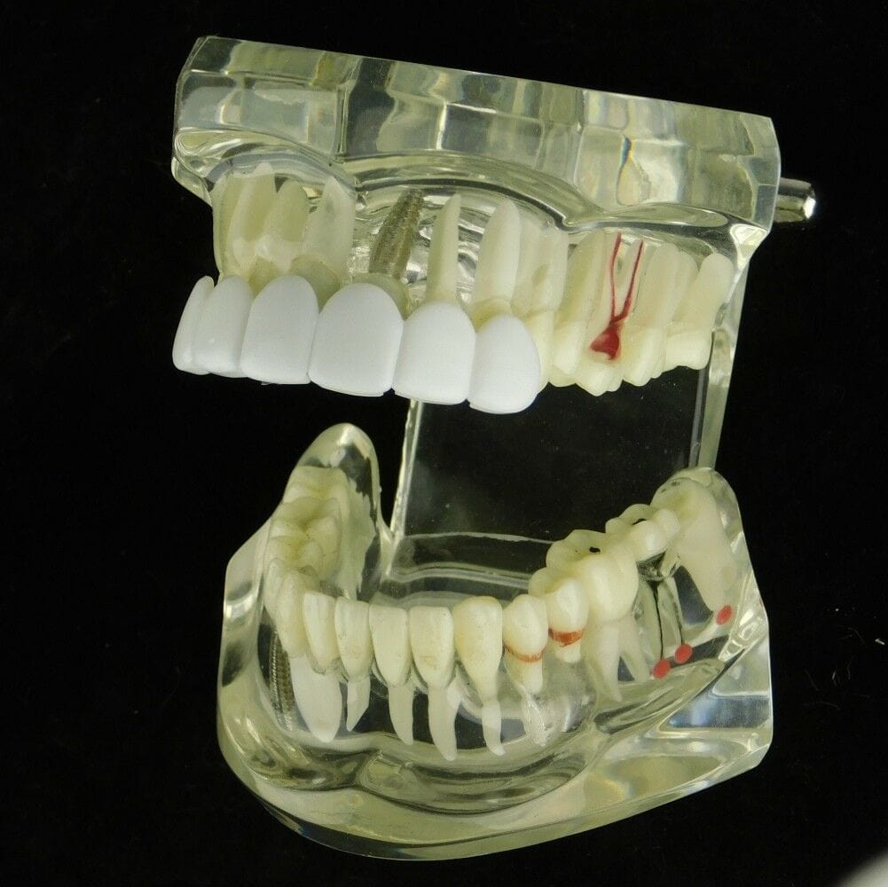 White Top Row Teeth Grillz