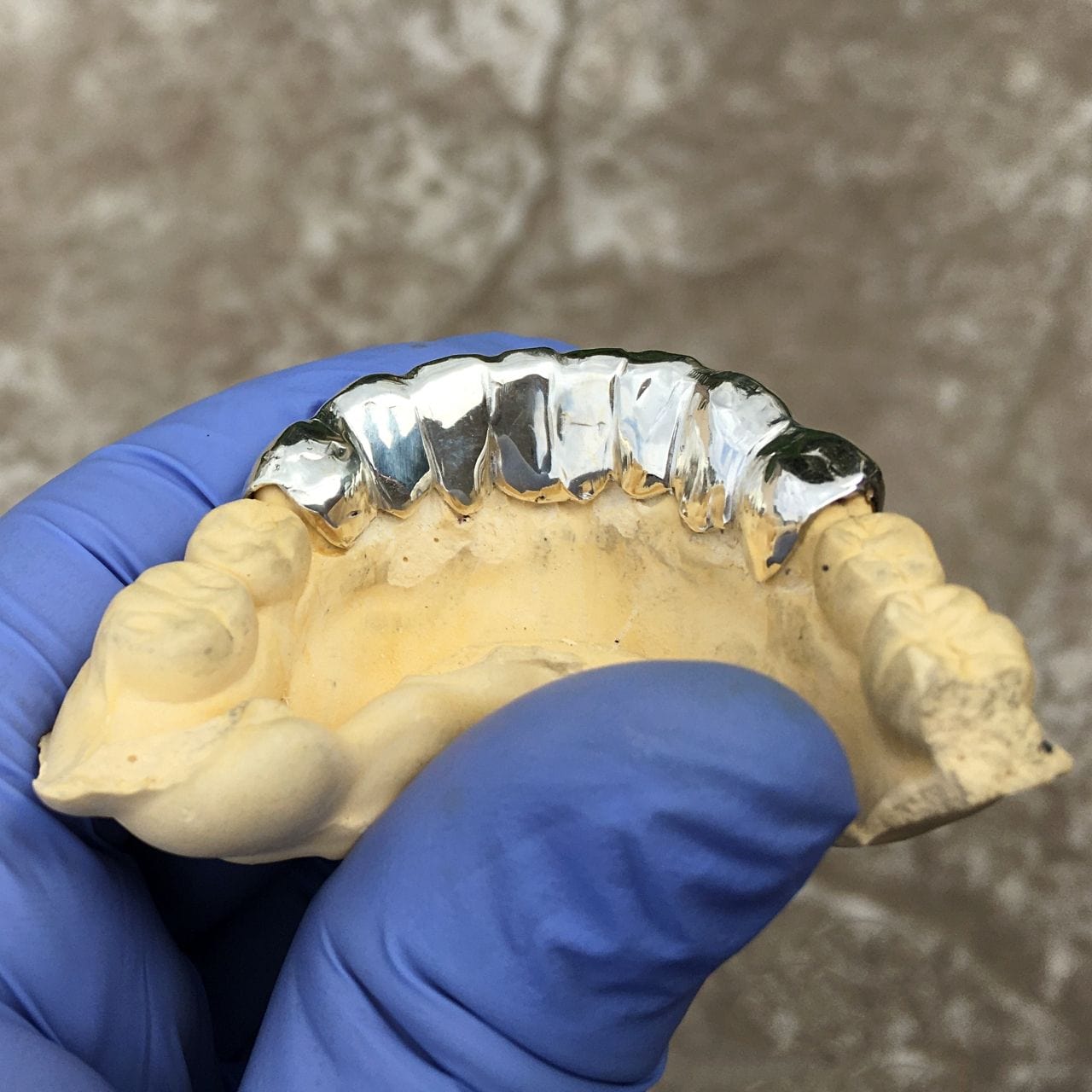 925 Sterling Silver Open Face Windows Custom Grillz